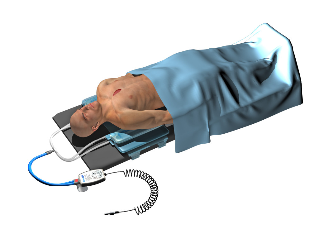 ThorAcc® Sternal Closure System