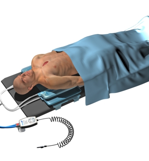 ThorAcc® Sternal Closure System